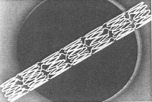 The MSM-BMS Coronary Stent
