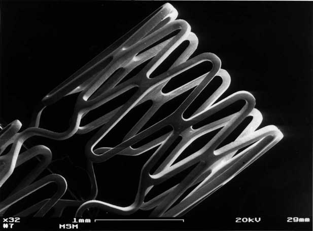 The MSM-BMS Coronary Stent